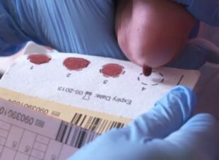 Newborn Blood Spot Screening – UK National Screening Committee