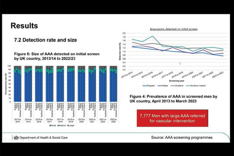 Abdominal Aortic Aneurysm Screening – UK National Screening Committee