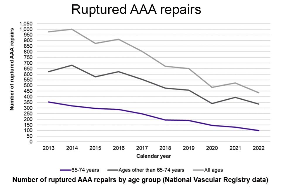 NHS AAA Screening Programme proves its effectiveness – UK National ...